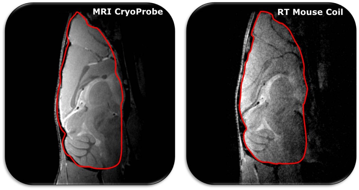 MRI Upgrade Program | MRI Instrument Upgrades | Bruker