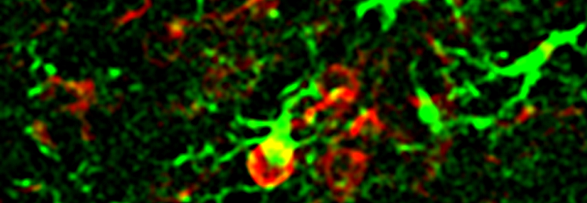 In Vivo Imaging of Microglia as the Brain’s Thermostat for Tuning ...