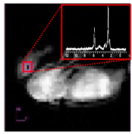 MR Microscopy & MR Diffusion | Bruker