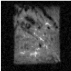 MR Microscopy Hardware | MR Microscopy Software | Bruker