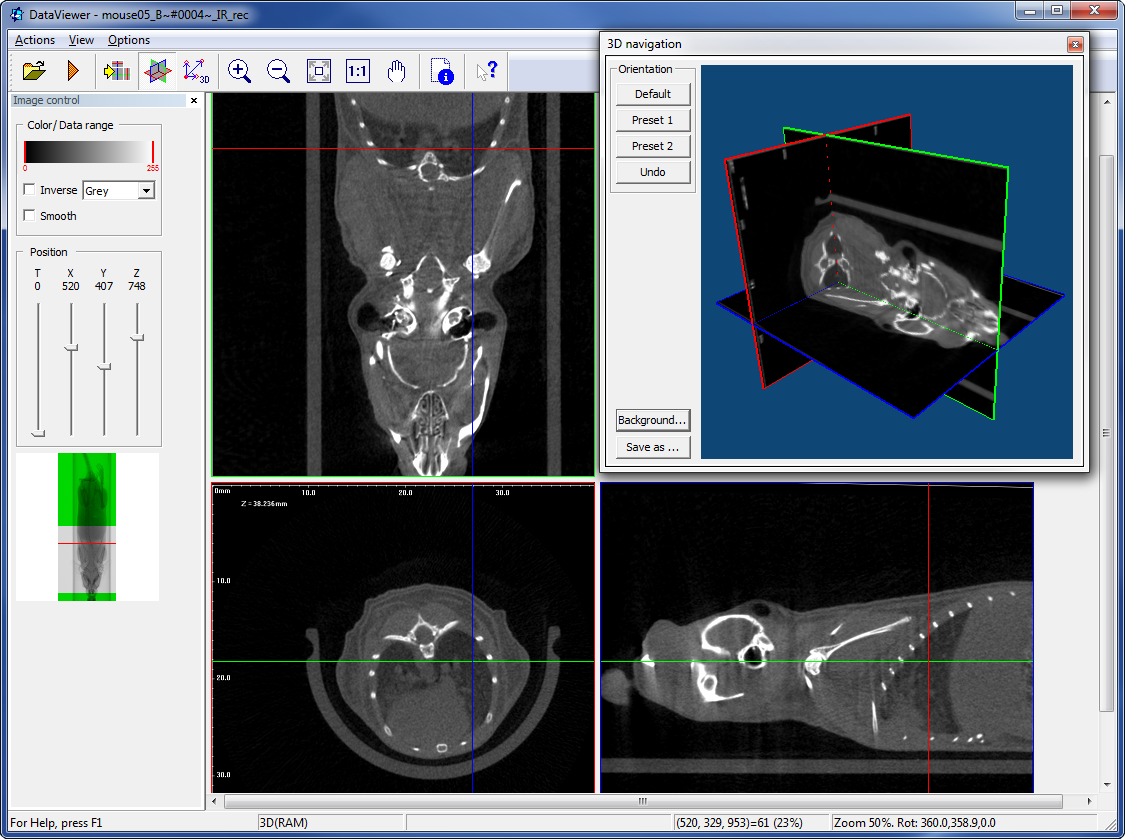 microCT Software | Internal Object Structure Analysis | Bruker