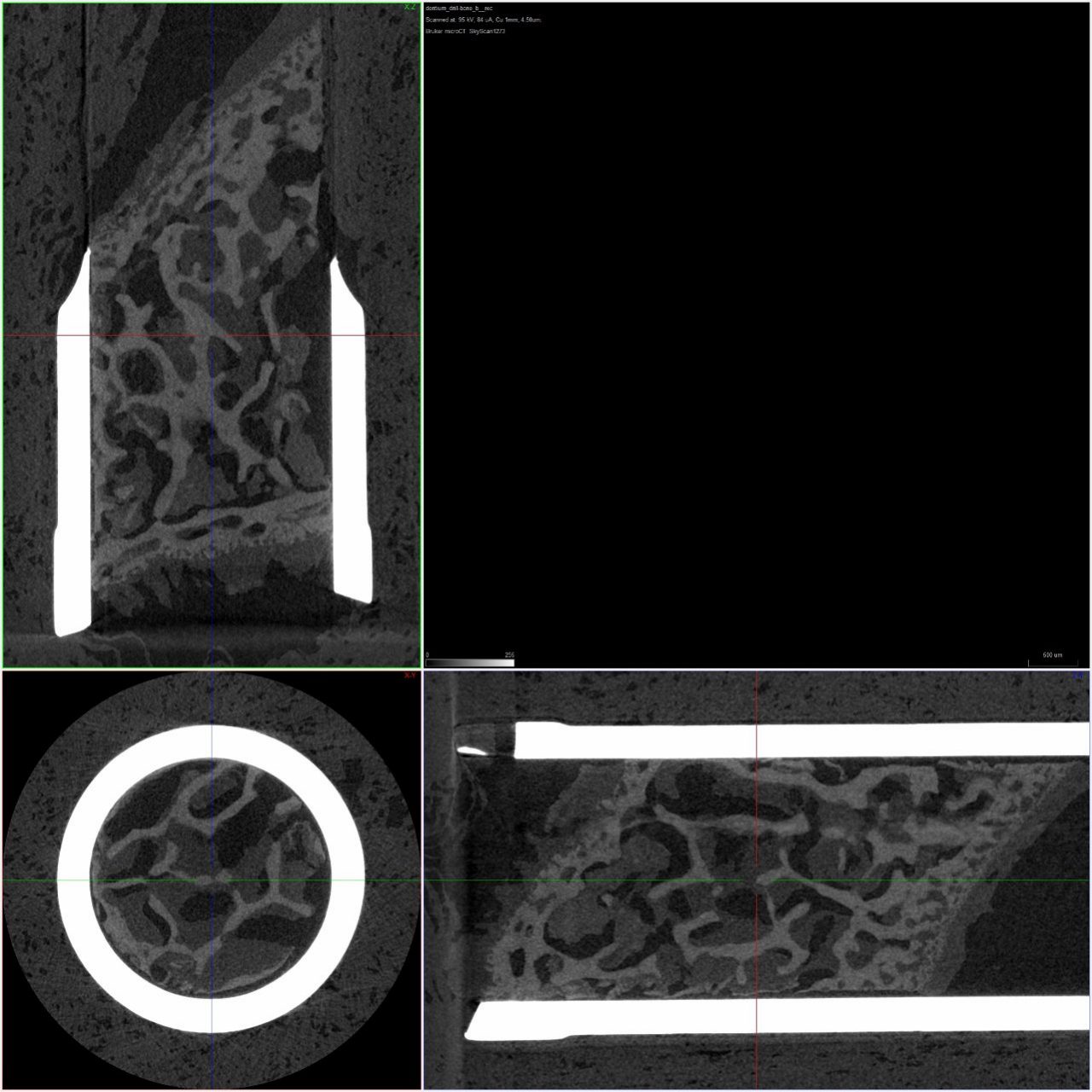 High Capacity 3D X-ray Microscopy | Solutions | SKYSCAN 1273 | Bruker