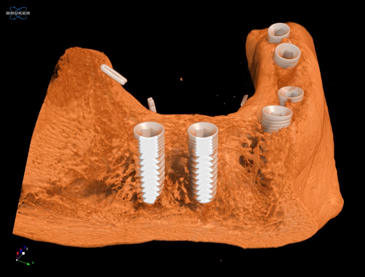 High Capacity 3D X-ray Microscopy | Solutions | SKYSCAN 1273 | Bruker
