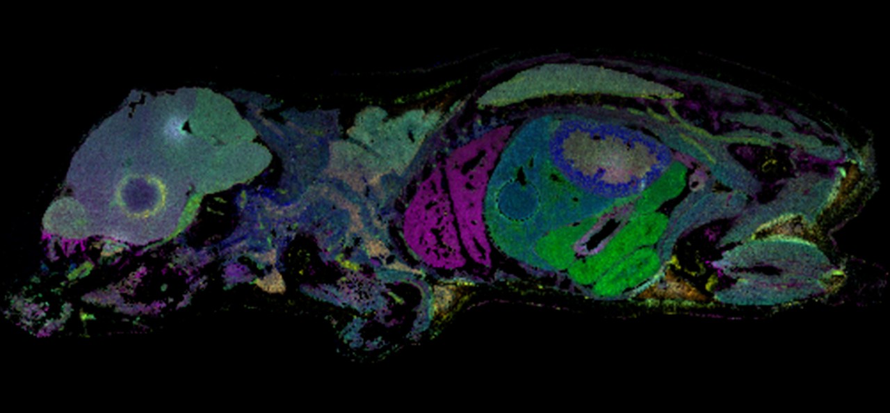 Mapping Tissue Carbohydrates Using Mass Spectrometry | Bruker