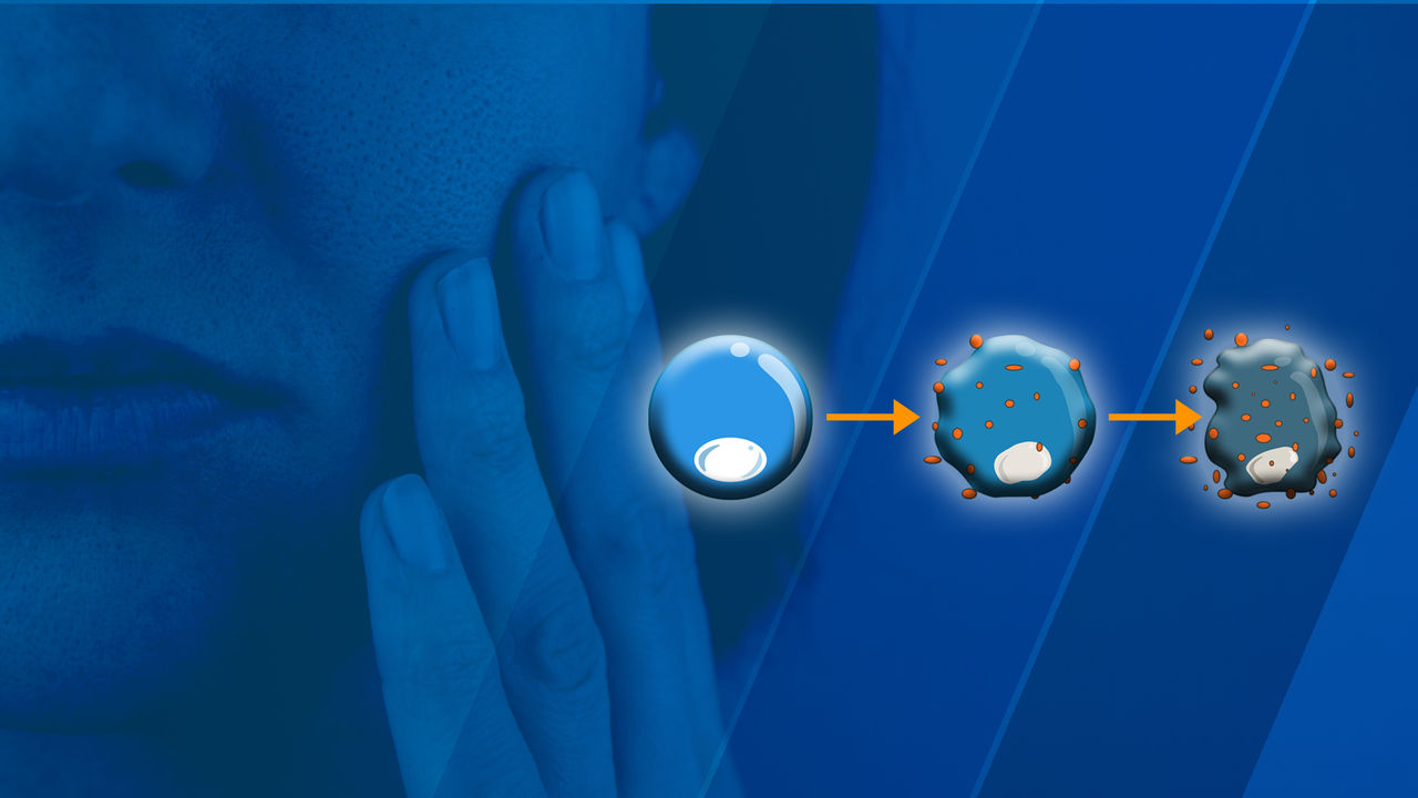 Redox Status of Skin and Blood Measured by EPR Spectroscopy | Bruker