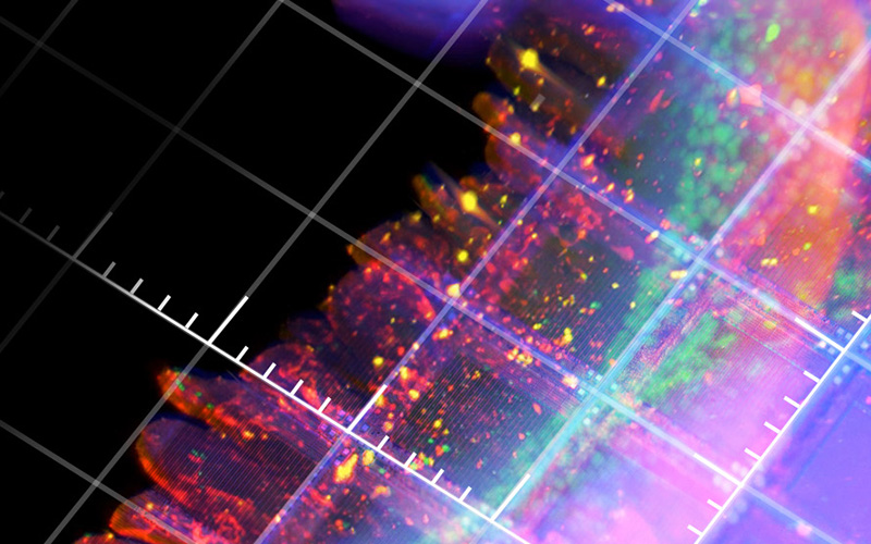 Effective Processing of Light-Sheet Microscopy Images with the Luxendo Image Processor | Bruker