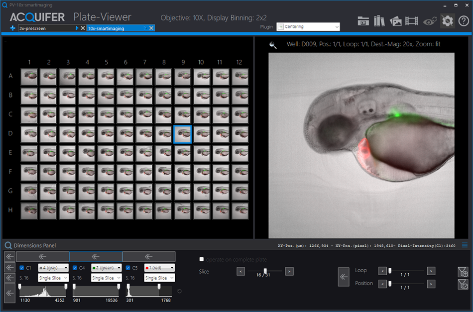 Supervised Feedback Microscopy with the Acquifer IM and Plate-Viewer | Bruker
