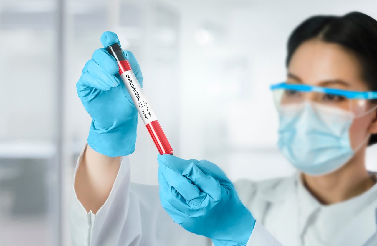 Demystifying diseases: Using NMR to understand Covid-19 at the molecular level | Bruker