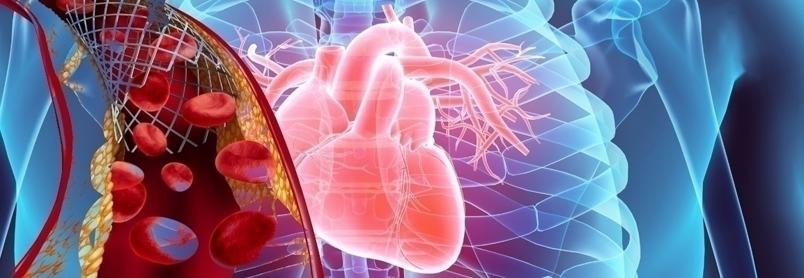 Studying Cardiovascular Pathology with MRI | Bruker