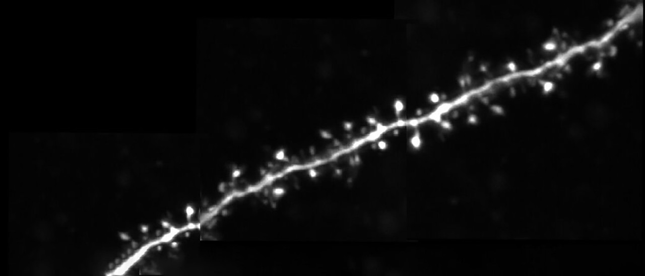 A Spike-Timing Dependent Plasticity Rule for Dendritic Spines | Bruker