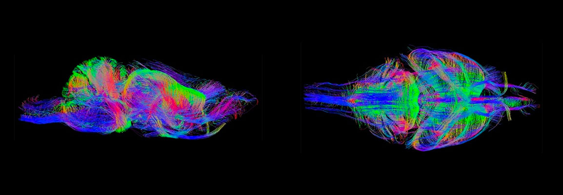 Diffusion MR: Basics and Applications | Bruker