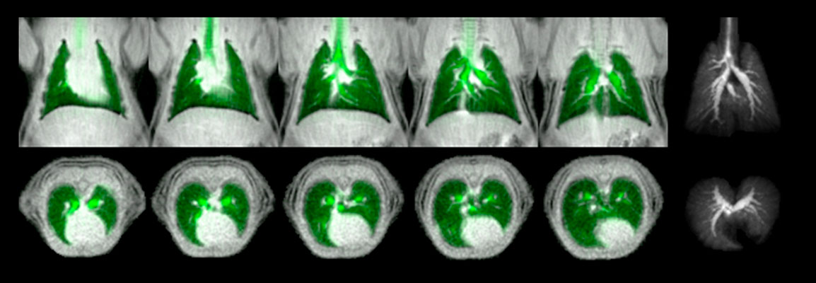 Hyperpolarized 129Xe MRI of Pulmonary Gas-Exchange in Rodents | Bruker