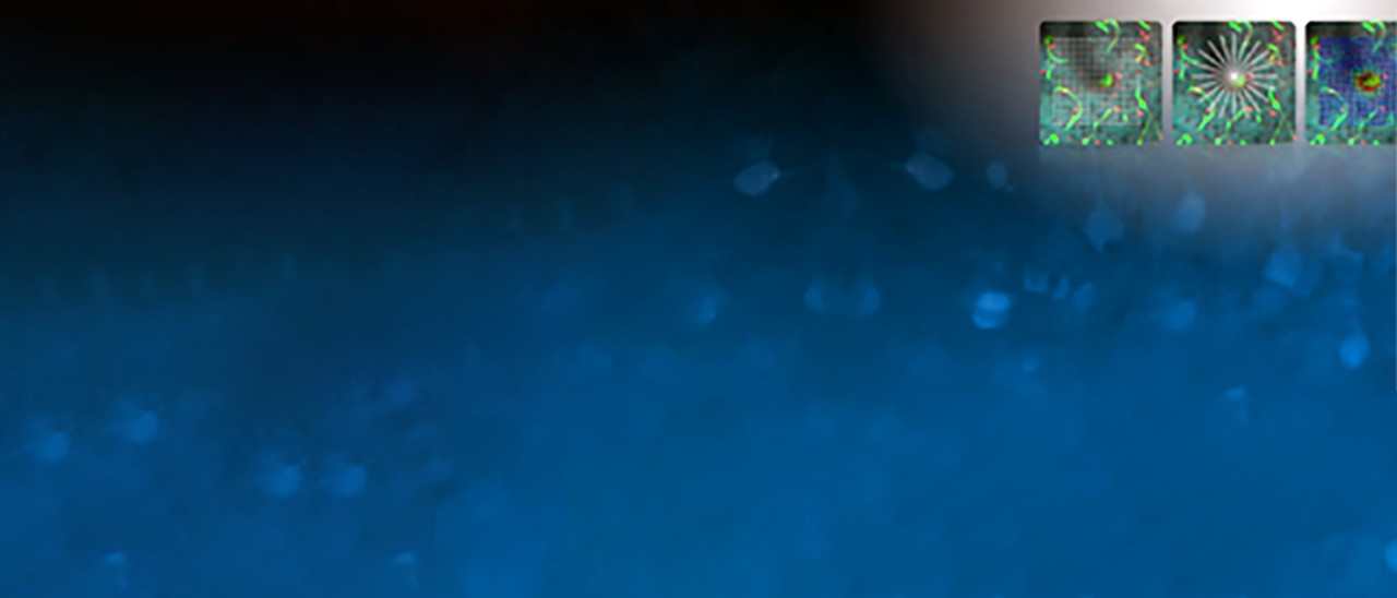 Two-photon-based Phosphorescence Lifetime Imaging (2P-PLIM) for in Vivo ...