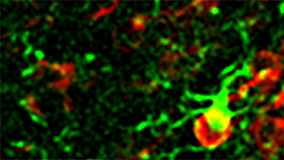 In Vivo Imaging of Microglia as the Brain’s Thermostat for Tuning ...
