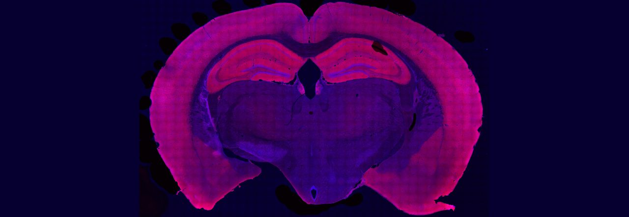 Mapping fMRI networks in the awake mouse | Bruker Mapping fMRI networks in the awake mouse | Bruker