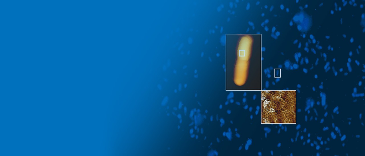 Correlative Optical Microscopy and AFM: Enhancing Biological Studies ...