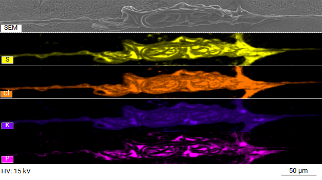 Analytical Cryo-SEM EDS Mapping for Life Science Applications | Bruker