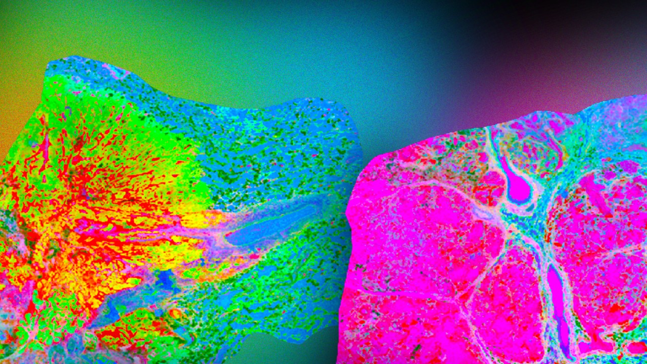 LabCast: More insight per pixel in spatial biology applications using ...