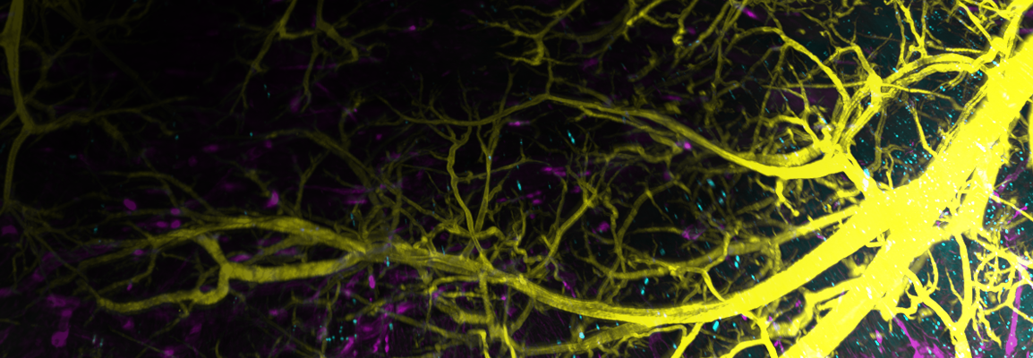 Bruker Fluorescence Microscopy Solutions: Automated Imaging and Light ...