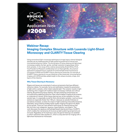 AN2004 Imaging Complex Structure with Luxendo Light-Sheet Microscopy ...