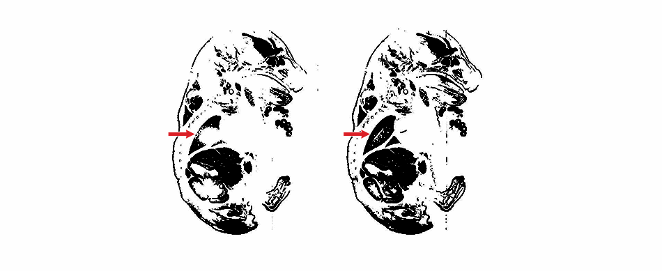 Flatfield Correction in Light-Sheet Fluorescence Microscopy | Bruker