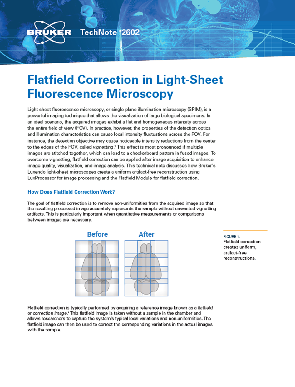 Flatfield Correction in Light-Sheet Fluorescence Microscopy | Bruker