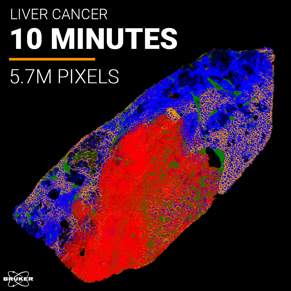 IR Guided MALDI Imaging | Bruker