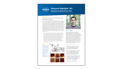 [Free PDF] Research Highlight - Dr. Alexander Cartagena-Rivera | Bruker