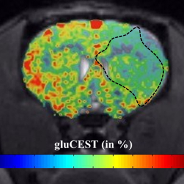 ParaVision 360 亮点 | Bruker